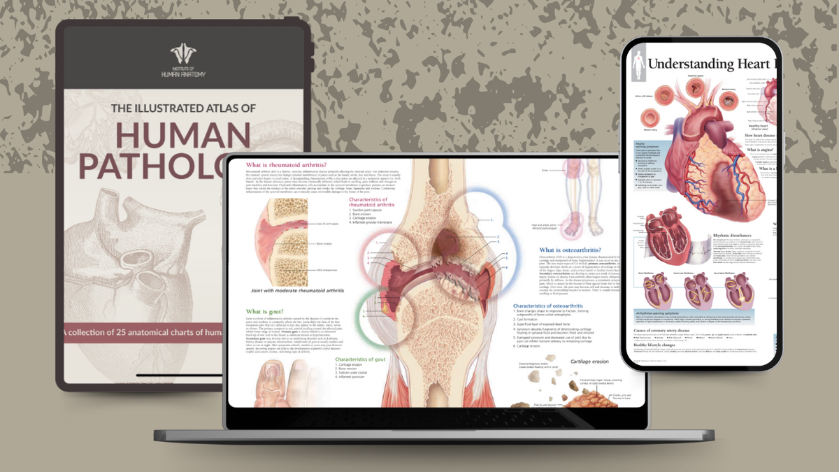 Illustrated Atlas of Human Pathology - eBook